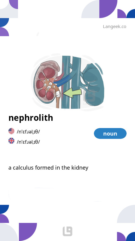 Definition & Meaning of "Nephrolith" | Picture Dictionary